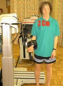 Shoulder Flexion / Extension – Isokinetics.net